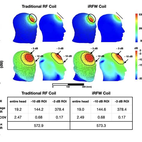A Snr Maps For The Simulated A 40 Mm Traditional Rf Coil And Irfw Download Scientific