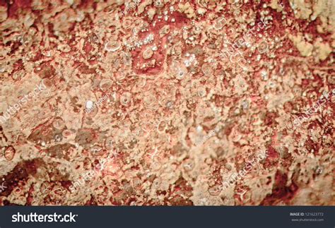 Micrograph Medical Science Simple Squamous Epithelium Foto Stock Shutterstock