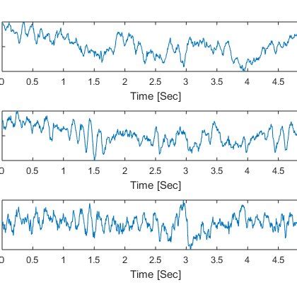 Sample EEG Signal Of AD Patient From Three Electrode P P And O Download Scientific Diagram