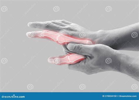 Homme Souffrant De Douleurs Osseuses Dans Lindex Doigt Et Le Pouce Photo Stock Image Du