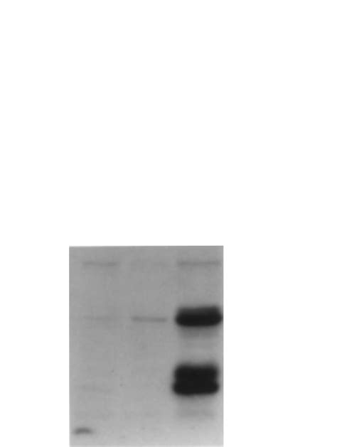 Ectopic Expression Of Gpc3 In Human Mm Cells A Northern Blot Showing Download Scientific
