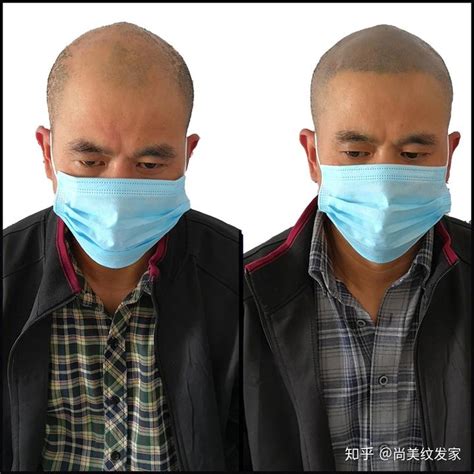 这些知道了，纹发就可以安心了！ 知乎