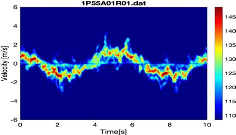 Spectrogram Of Walking Pattern Download Scientific Diagram