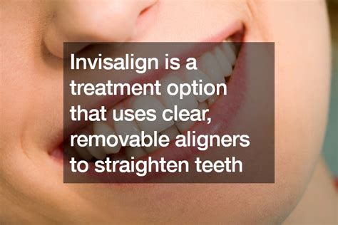 How Does Invisalign Really Work Thoughts On The Way