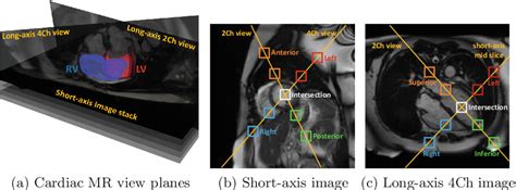Figure 1 From Mr Image Segmentation By Anatomical Position Prediction Semantic Scholar