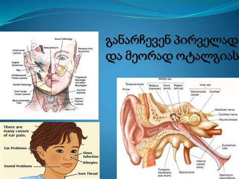 ყურის ტკივილის დიაგნოსტიკა და მართვა ზოგად საექიმო პრაქტიკაში презентация онлайн