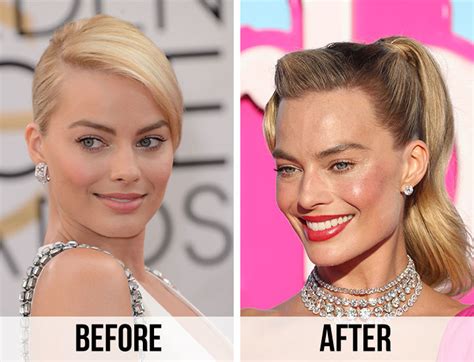 Has Margot Robbie Had A Nose Job And Buccal Fat Removal Doctors Weigh