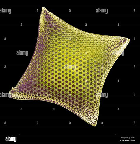 Diatom Coloured Scanning Electron Micrograph Sem Of A Triceratium Sp Var Quadrata Diatom