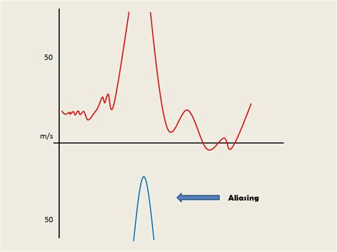 The Pump And The Tubes Pulsed Wave Doppler And Aliasing