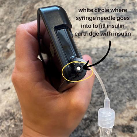 Tandem Tslim X2 With Control Iq Insulin Pump Review