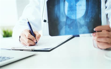 엑스레이 또는 Roentgen 심상을 들고 의학 양식에 있는 메모를 만드는 여성 닥터의 가까이 X 레이에 대한 스톡 사진 및 기타 이미지 Istock