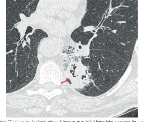 Figure 1 From Quality Improvement In Radiology Reporting By Imaging Informatics And Machine