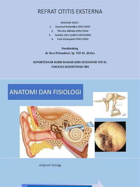 Otitis Eksterna Pdf