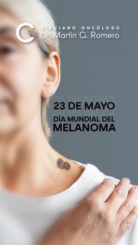 🌞 Día Mundial Del Melanoma 23 De Mayo 🌞 El Melanoma Es Un Agresivo Cáncer De Piel Que Se