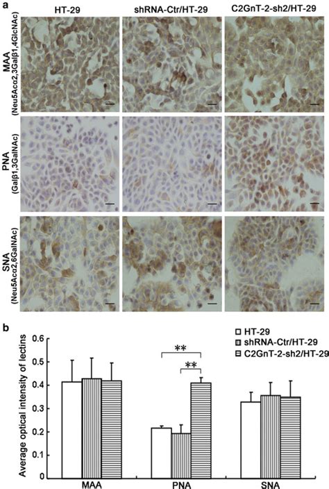 Lectin Histochemical Staining In Ht 29 Shrna Ctr Ht 29 And Shrna Download Scientific Diagram