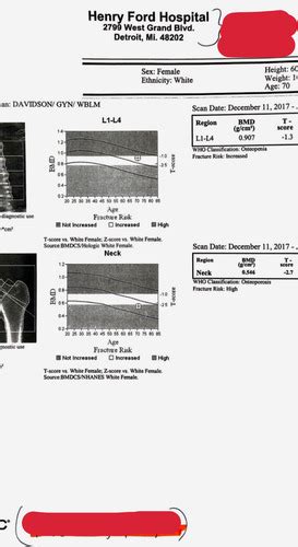 Bone Density Final Review Flashcards Quizlet