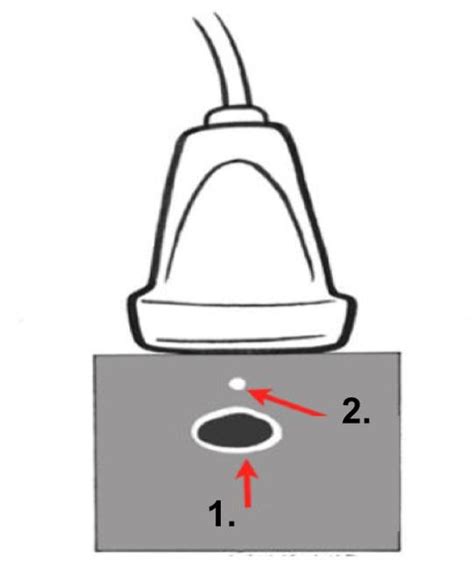 Graphic Proximal Ultrasound View Sonosite Institute For Point Of Care Ultrasound