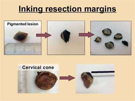 Histopathology In Practice Sample Reception Dissection Processing…