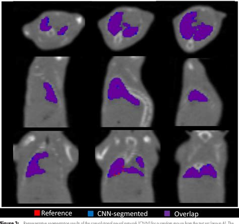 Figure 3 From Deep Learningbased Automatic Lung Segmentation On
