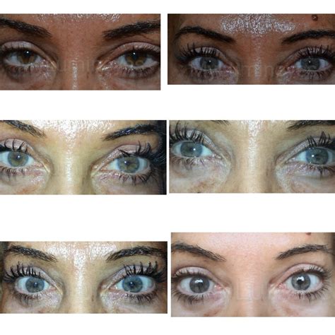 Clinical Photo Archive Illustrative Lumineyes