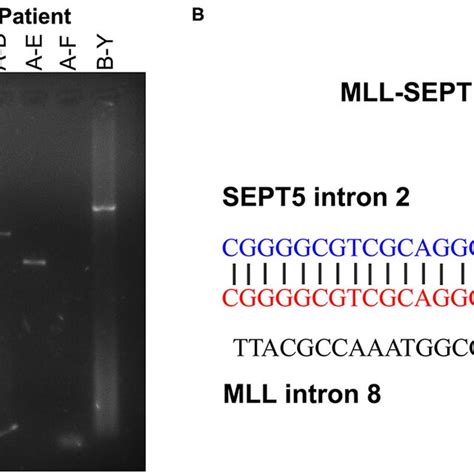 Ldi Pcr Analyses Of Mll Translocation Partner Gene A Genomic Dna Of Download Scientific