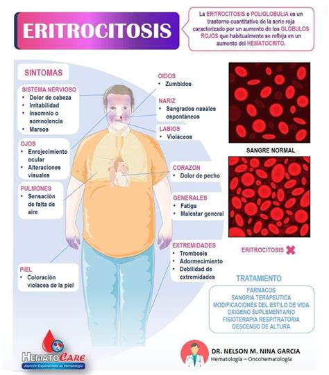 Dr Eritrocitosis Ó Poliglobulia La Eritrocitosis O Poliglobulia Es Un Trastorno Caracterizado