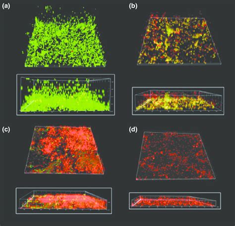 The Three Dimensional Confocal Laser Scanning Microscopy Reconstruction