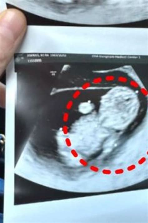 임신 황보라 지쳐서 안 한다 난 될 때까지 시험관 4차 진행 소감에 모두 오열