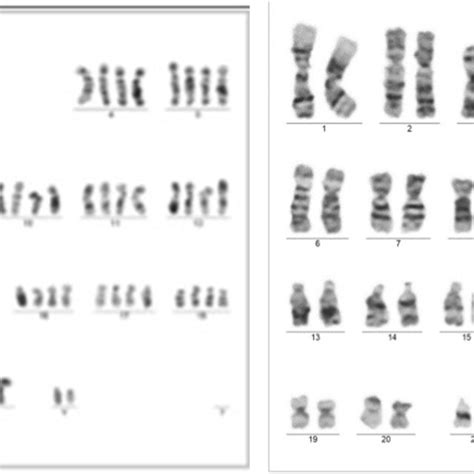 Snp Array Arr X Y1 122x2 Download Scientific Diagram