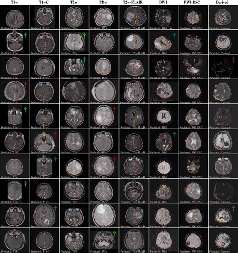 Saliency Maps And Predicted Scan Type Of Randomly Drawn Samples From Download Scientific