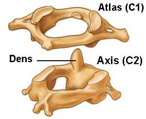 Upper Cervical Terms Defined Asc Wellnessadvanced Spinal Care