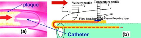 A A Polymer Based Shear Stress Sensor In A Model Of Rabbit Aorta B