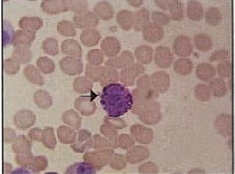 Fichero Hematologia Basofilo