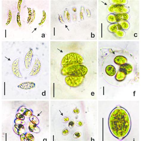 A I A Trochiscia Aciculifera B C Botryococcus Braunii D G Download Scientific Diagram