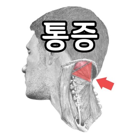 뒷목·뒷골이 땡기는 이유 통증 원인 증상 예방법 및 목지압기 소개 네이버 블로그