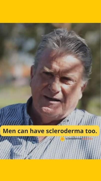 Scleroderma Australia On Linkedin Sclerodermaaustralia Sclerodermaawareness Scleroderma
