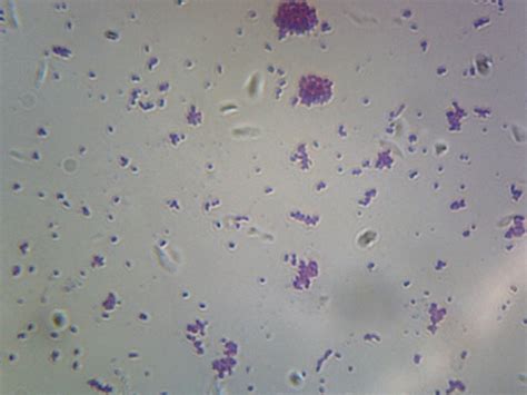 Coccus Smear Gram Negative Nebraska Scientific