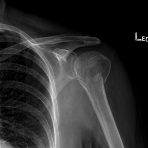 Msk Radiograph Case 14