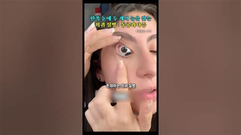 실제 있는 사륜안 Youtube