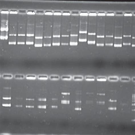 Recombinants Showing 1 2 Kb Inserts • Well 19 Puc18 Vector Plasmid Download Scientific Diagram