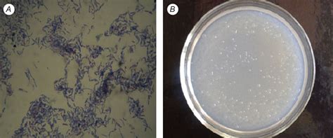 Microphotography Of The Association Of Sporulated Silicate Bacteriae Download Scientific