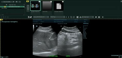 7 Key Benefits Of Pacs In Radiology Improving Patient Care