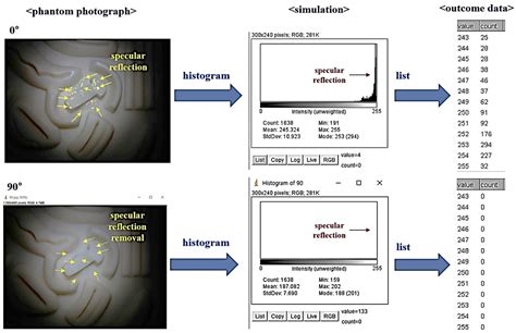 Specular Reflection Ultrasound
