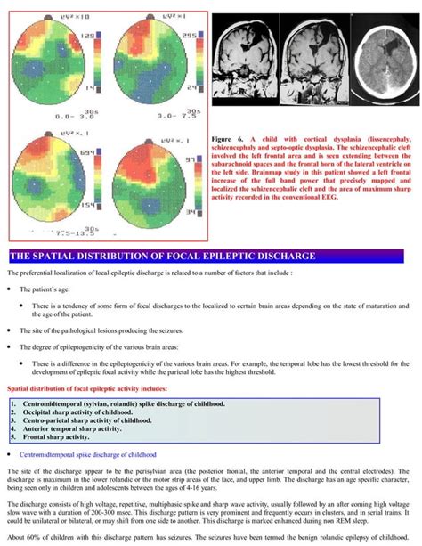 Issues In Brainmappingbrainmapping And Focal Epileptic Disorders Pdf