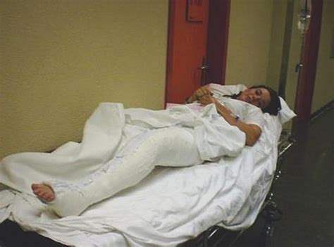 Llc Very High Long Leg Cast Nice Toes What A Cutie Leg Cast Long Leg Cast Nice Toes