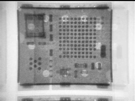 X Ray Detection Classification Model By Spacelab