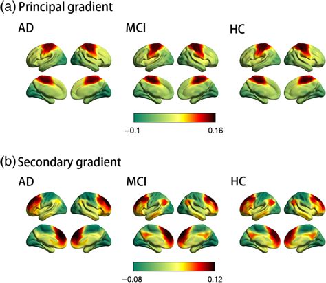 Connectome Gradient Mapping In The Alzheimers Disease Ad Mild Download Scientific Diagram