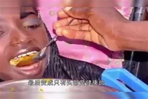 妙龄少女身残志坚，身体几乎只剩头部，在塑料盆生活19年塑料盆头部身体