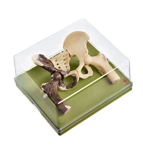 Somso Reconstruction Of The Pelvis Of Australopithecus Africanus