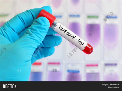 Test Tube Blood Sample Lipid Panel Image Photo Bigstock